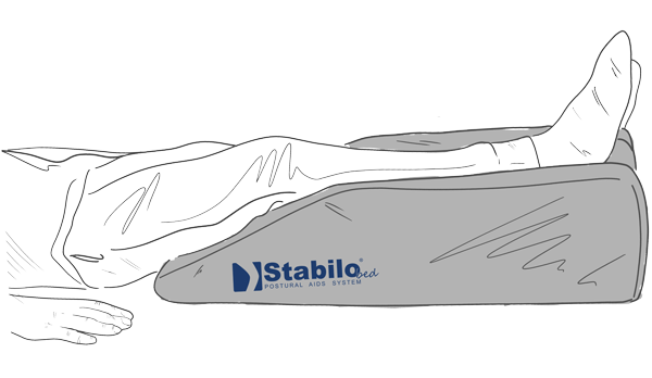StabiloBed® Braunschiene - Hochlagerung nach Beinoperation